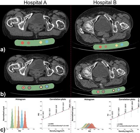 Automated Segmentation Of An Intensity Calibration Phantom In Clinical Ct Images Using A