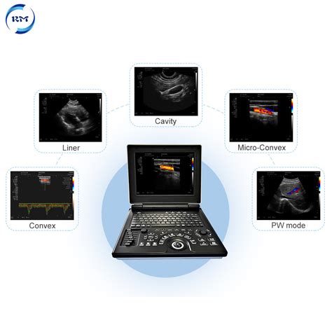 Clinic Hospital Ultrasonido Portatil Color Doppler Ultrasonic Diagnostic System Color Doppler
