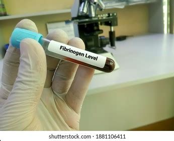 Fibrinogen Stock Photos Images Photography Shutterstock