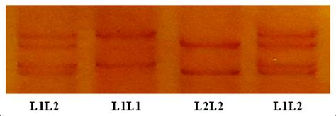 Polymerase Chain Reaction Single Stranded Conformational Polymorphism Download Scientific