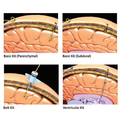 Codman Microsensor ICP Transducer
