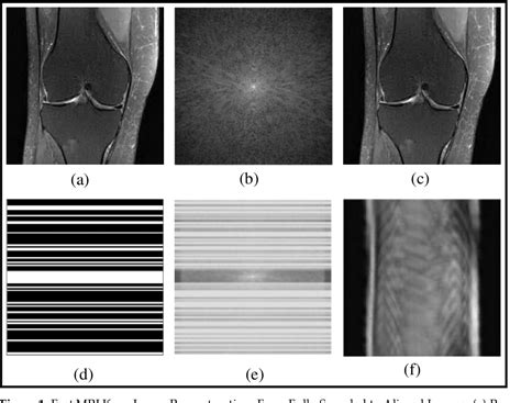 figure 1 from emerging trends in fast mri using deep learning