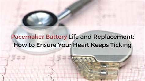 Pacemaker Battery Life And Replacement Mhv