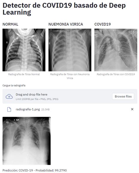 GitHub Gabvillacis Covid Detection App Covid Detection Streamlit App Based On Deep Learning