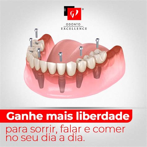 Prótese Dentária Em Botucatu Sp Classificados Solutudo