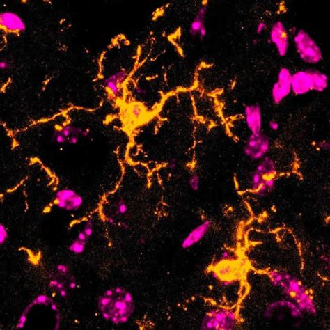 Microglia React Distinctly During Inflammation Neuroscience News