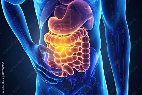 Crohns Disease Inflammatory Bowel Disease Causing Abdominal Pain And