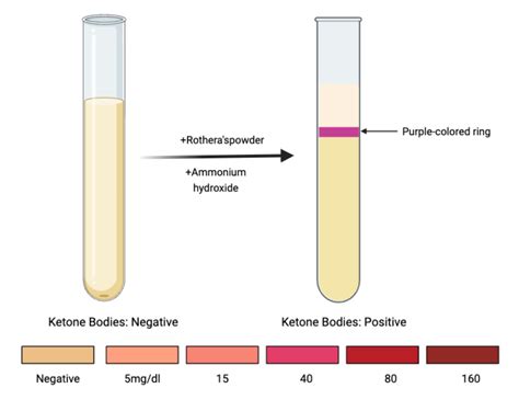 Hydrogen Sulfide H2s Test Principle Procedure Result Biology