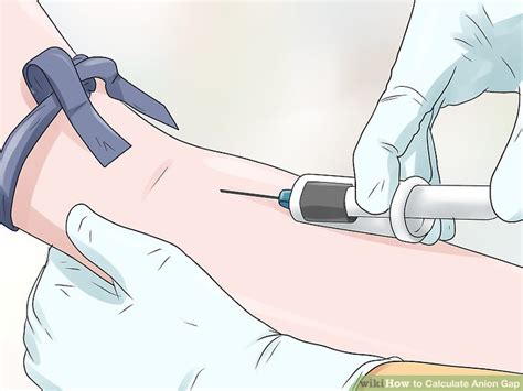 How To Calculate Anion Gap Steps With Pictures WikiHow