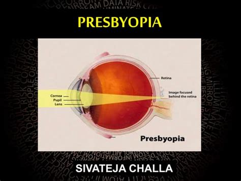 Presbyopia Pptx