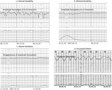 Frontiers Ai Assisted Fetal Heart Monitoring A Ctg Classification