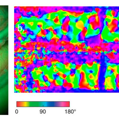 A Microscopy View Of The Ecog Electrode Positioned On The Cortical