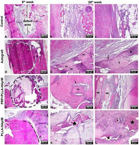Histological Sections Of Rat Cranial Defect And Surrounding Tissues