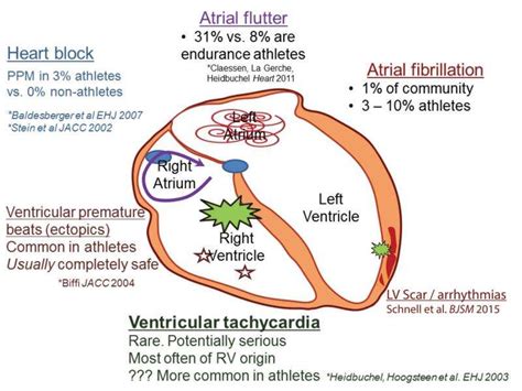 Benign Neonatal Ocular Flutter Readinghop