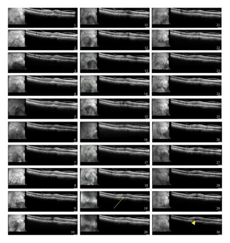Daily Cross Sectional One Line Optical Coherence Tomography OCT Download Scientific Diagram