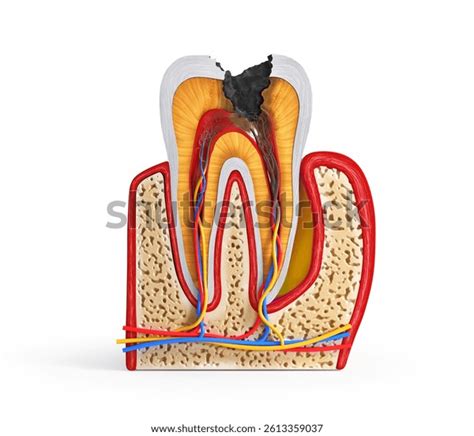 Human Tooth Structure Cross Section Scheme Stock Illustration 2613359037 Shutterstock