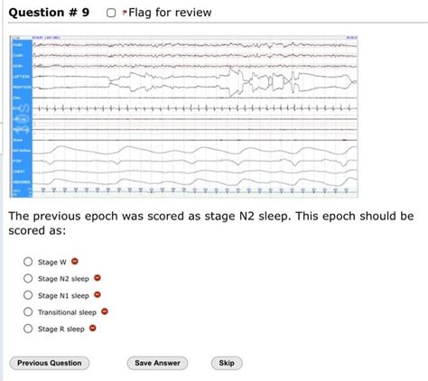 Solved Question 90 Flag For Review Ca Letro Me The