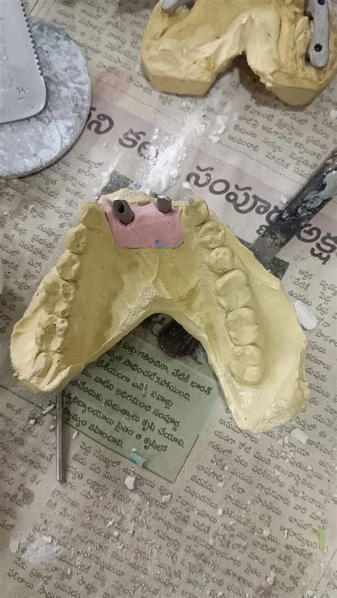 Metal Implants Lab At ₹ 500 Piece In Hyderabad Id 2852159062688