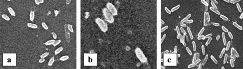 Scanning Electron Microscopic Image Of A Isolate S4 Magnification