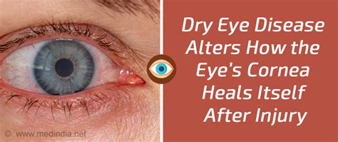 Dry Eye Disease Can Alter Healing Of The Cornea Post Injury