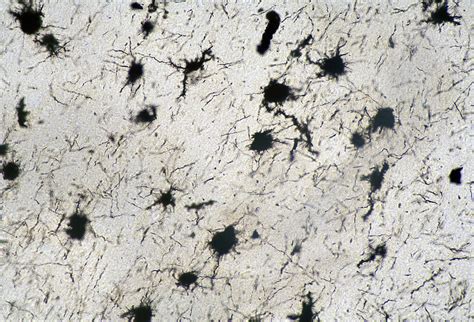 Cerebrum Neurons Golgi Stain Lm Photograph By Science Stock