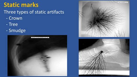 Artifacts In General Radiography For Radiodeptpptx