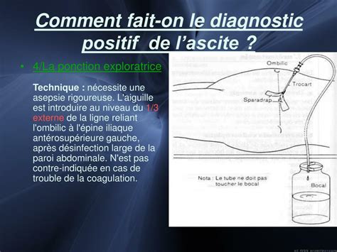 Ppt Lascite Powerpoint Presentation Free Download Id 4011803