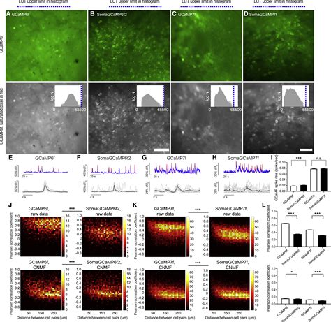 Precision Calcium Imaging Of Dense Neural Populations Via A Cell Body