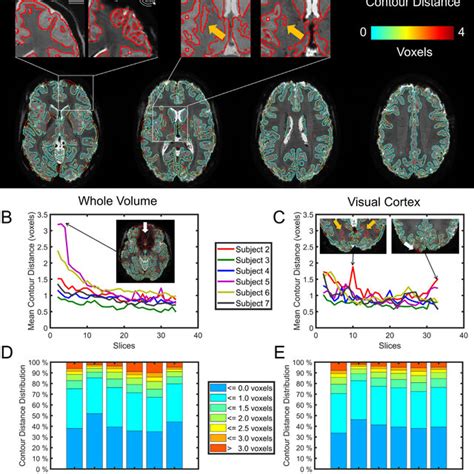 Quantification Of Spatial Specificity In Spiral Images Via Contour Download Scientific Diagram