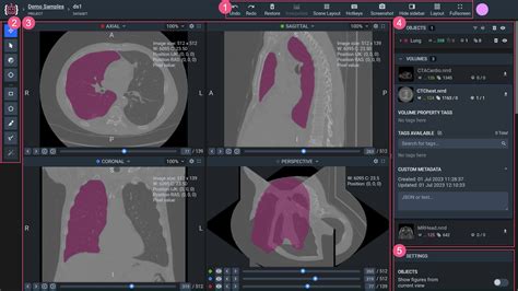 Best Dicom And Nifti Annotation Tools For Medical Imaging Ai Supervisely