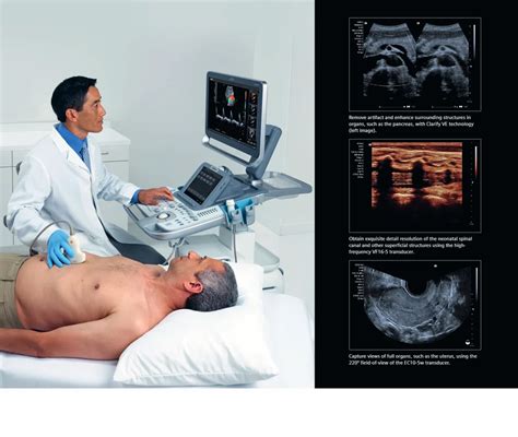 Siemens Ultrasound Machines 17 Inch At ₹ 3500000 In Patna Id