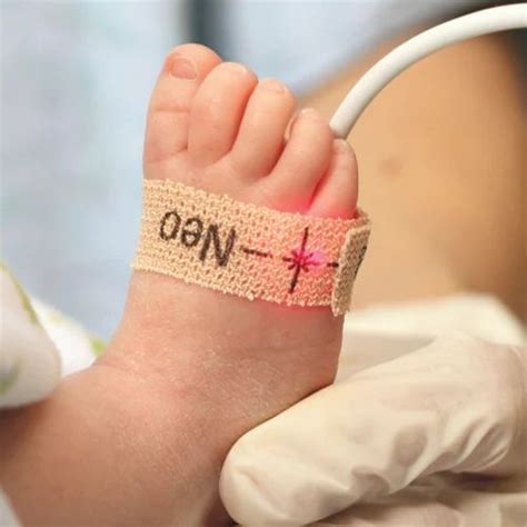 Disposable Neonatal Nellcor Spo2 Sensor At ₹ 150 Piece Malka Ganj New Delhi Id 14110247262