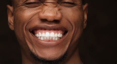 Шүдний цайруулах эмчилгээ Cuticul Dental Clinic