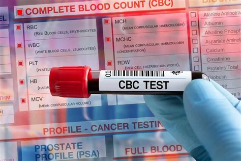 CBC Blood Test What It Reveals About Your Health
