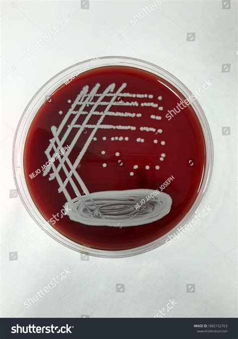 Staphylococcus Epidermidis Agar Plate