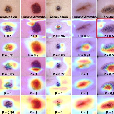 Grad Cam Visualization Results We Compare The Visualization Results Download Scientific