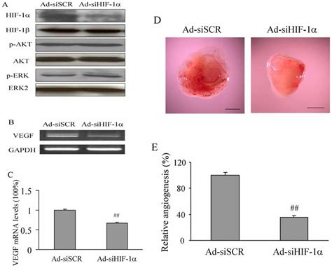 Hif 1a Expression Is Required In Mir 21 Inducing Vegf Expression And