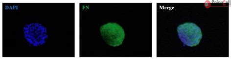 Ready To Use 3d Human Bronchial Fibroblast Spheroids Sp3d Hbfs