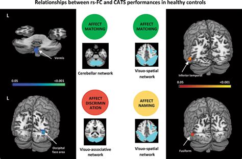 Independent Component Analysis Relationship Between Resting State Download Scientific Diagram