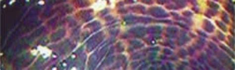 Episode 36 The Mystery Of Melanosis Coli The Curious Clinicians