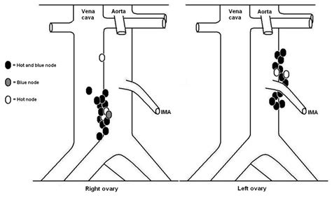 Locations Of Sentinel Lymph Nodes After Tracer Injections To The Right