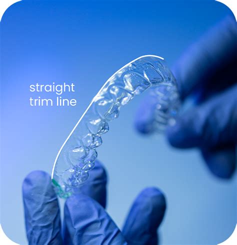 The Impact Of Aligner Trim Lines On Your Clear Aligner Journey