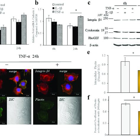 Tnf α Affects The Formation Of Hemidesmosomes Effects Of Il 1β 1