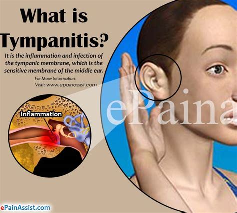 Tympanitis Causes Signs Symptoms Treatment Home Remedies
