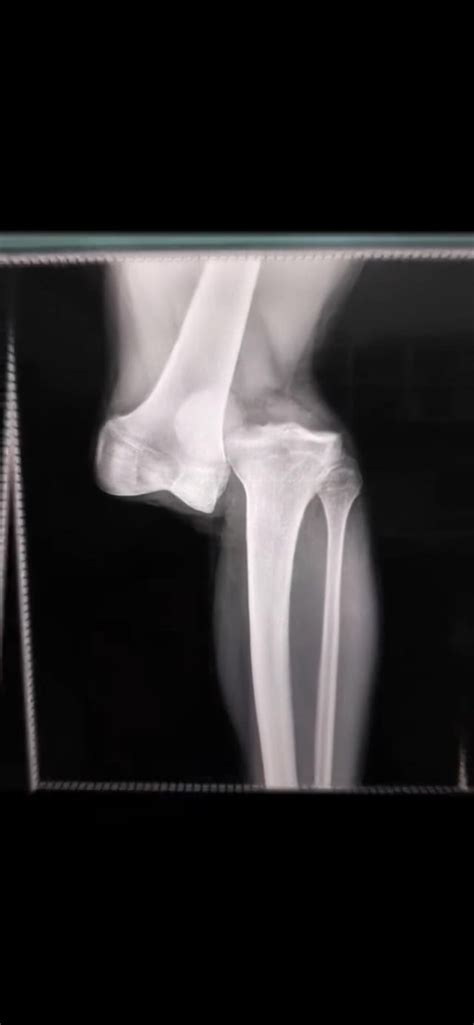 International Hcpc Registration R Physiotherapy