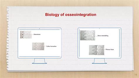 Temporary Anchorage Device Tads Pptx