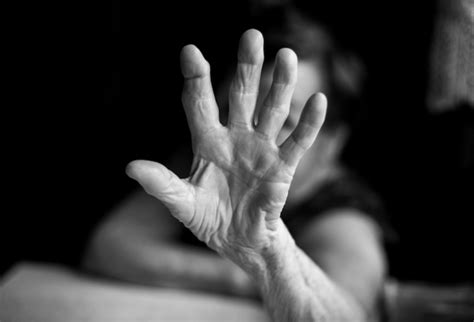 Un Armm De Nouvelle Génération Ortho Rhumato