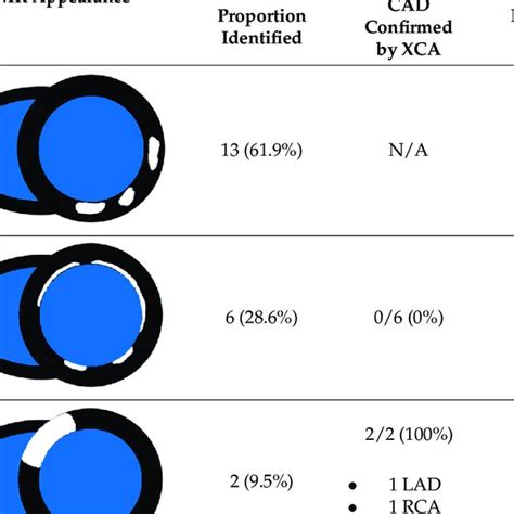 Prevalence Of Different Patterns Of Myocardial Fibrosis In Patients