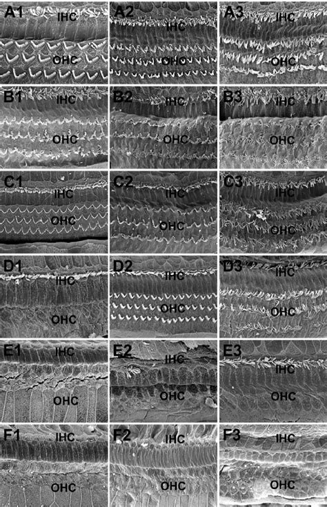 Scanning Electron Microscopy To Evaluate The Cochlear Toxicity Of Download Scientific Diagram