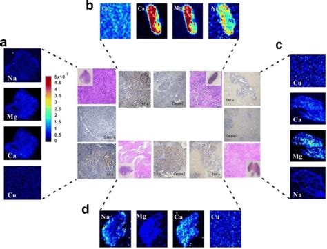 Libs Multi Elemental Imaging Combined With Histopathological Analysis Download Scientific Libs Multi Elemental Imaging Combined With Histopathological Analysis Download Scientific